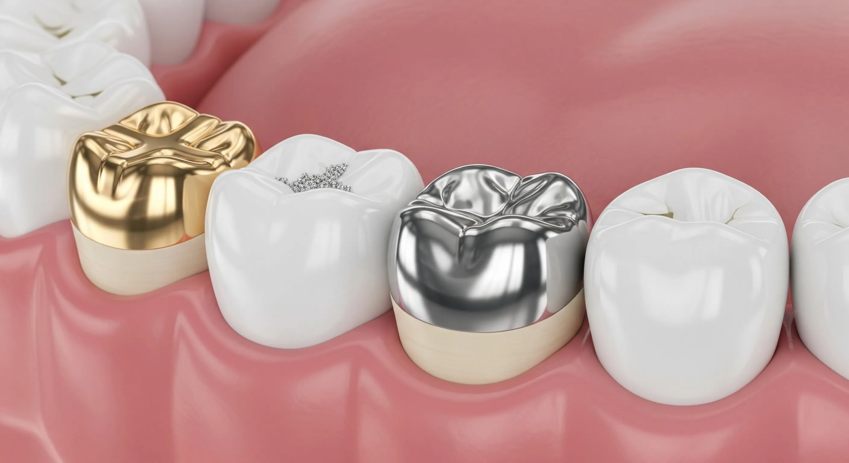 Reno Dental care and Orthodontics | Family & Cosmetic Dental Care